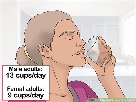 3 Ways To Get Rid Of An Itchy Scalp WikiHow