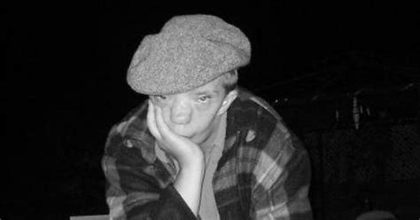 i have goldenhar syndrome you have seen me before i need your help