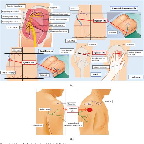 Subcutaneous Injection Subcutaneous Injection Intravenous 58 Off