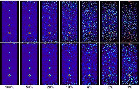 Sagittal View For Reconstructed Central Slices At Different Count Download Scientific Diagram