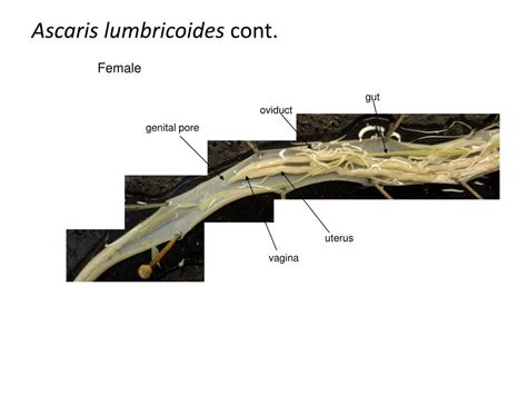 Ascaris Lumbricoides Dissection