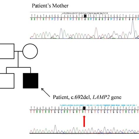 Pedigree Of The Patient And The Partial Dna Sequence Of Lamp2 Gene Of Download Scientific