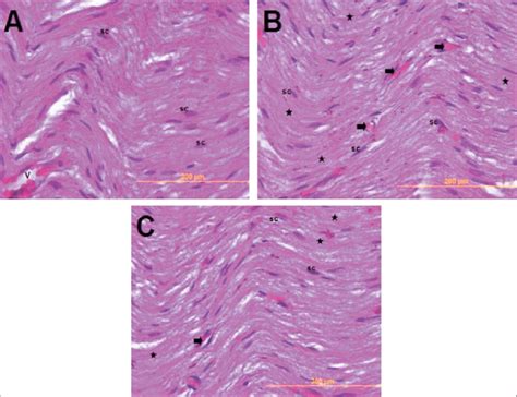 Nerve Histology