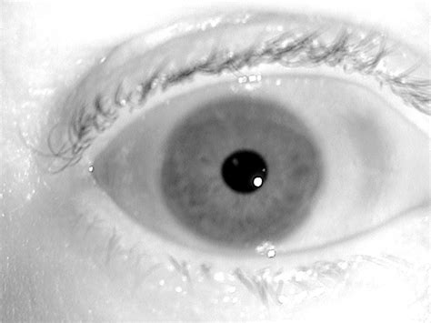 Iris Boundary Fitting Using Circular Hough Transform Applied To The