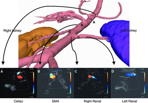 Landmark Points Chosen For System Registration Error Validation And Download Scientific Diagram