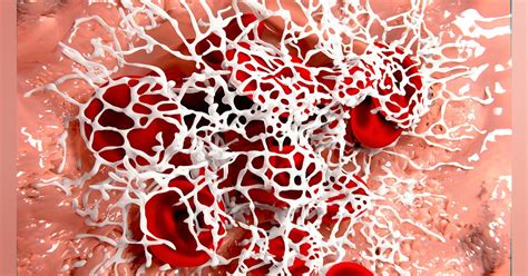 Fibrinogen Cardiovascular Disease And Periodontal Health Registered