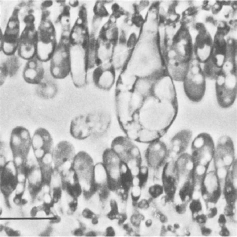 Branching Patterns At Cystidium Bases Cystidia Cy And Probasidia