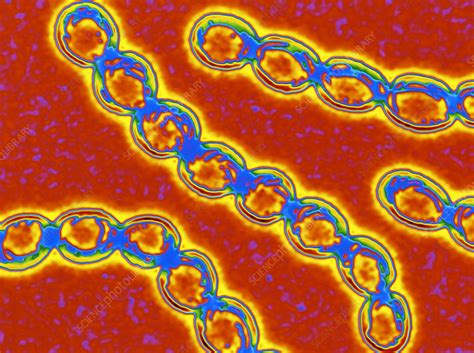 Chains Of Streptococcus Pyogenes Bacteria Stock Image B236 0093 Science Photo Library