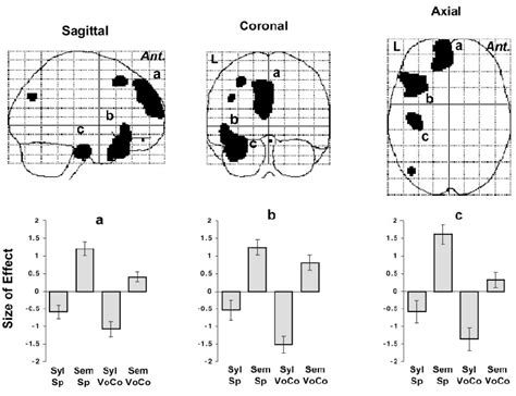 Statistical Parametric Maps Of The Main Effect Of Semantic Decision