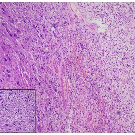 Nih Fletcher Criteria For Gist Risk Assessment Download Table