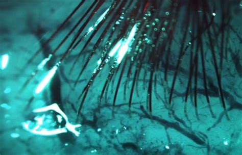 Elon Musks Neuralink Will Put Tiny Threads In Brains To Control Devices