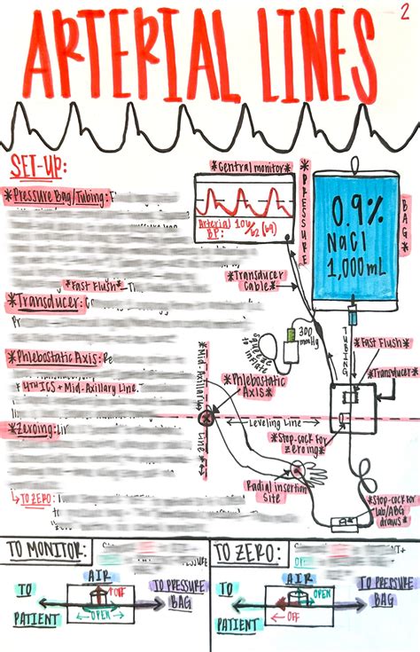 Arterial Line Digital Download Icu Nurse Reference Download Now Etsy
