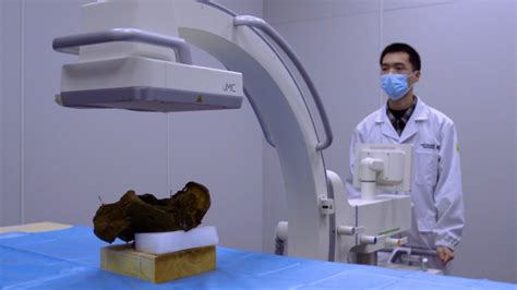 Video A Teleoperated Robotic System Assisted Percutaneous Transiliac