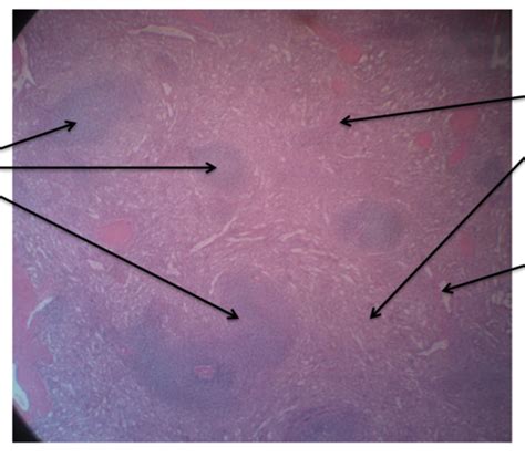 Bsc Lymphatic Lab Flashcards Quizlet