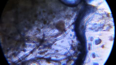 Found What Appears To Be Protozoa R Microscopy