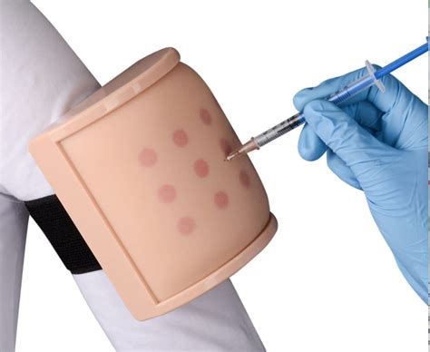 Subcutaneous Injection Technique