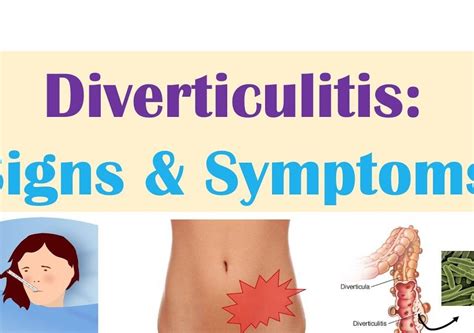 Diverticulitis Your Guide To Diverticulitis · Nvscc