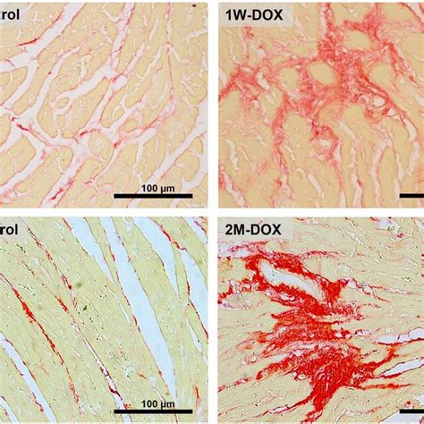 Sirius Red Staining Assessed By Light Microscopy Of Fibrosis In The Download Scientific Diagram