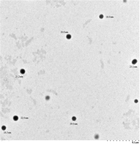 Transmission Electron Microscopy Of Optimized Formulation Download Scientific Diagram