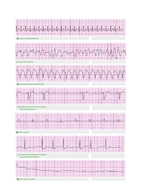 Acls Pdf