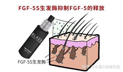新时代防脱方法，乐喜力丝从源头阻止脱发！ 知乎