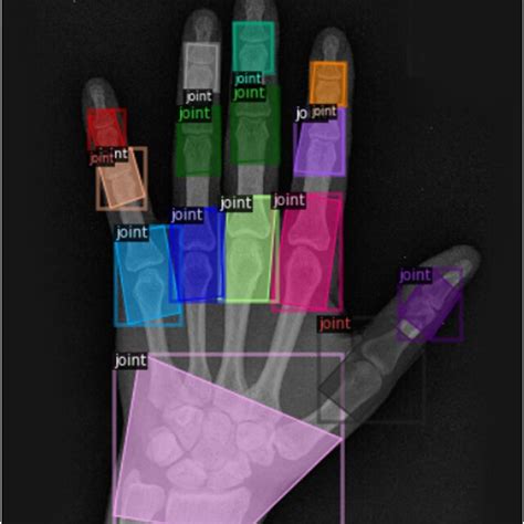 Output Of Neural Network Trained To Detect Joints In The Hands Download Scientific Diagram