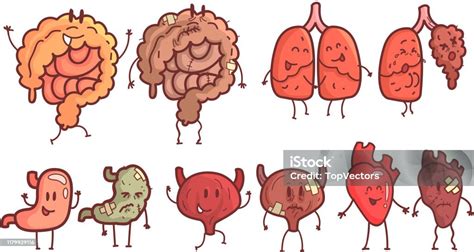 อวัยวะภายในของมนุษย์ที่มีสุขภาพดีและไม่แข็งแรงชุดตัวการ์ตูน กระเพาะปัสสาวะ หัวใจ ปอด ล ภาพประกอบ