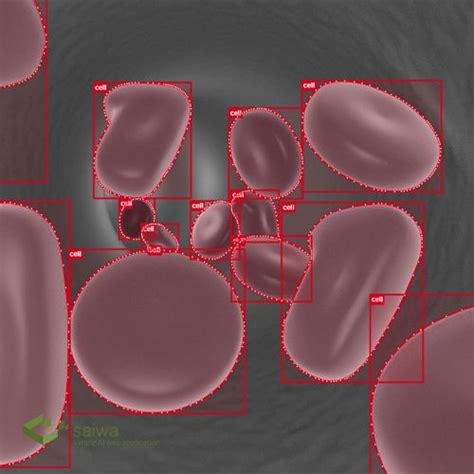 Medical Image Annotation