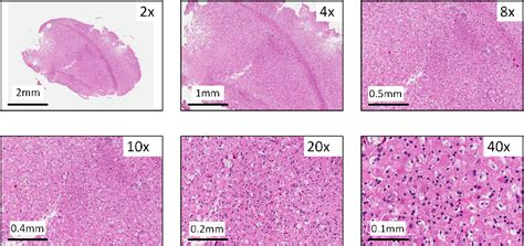 Figure 1 From Fractal Analysis In Digital Histology Semantic Scholar