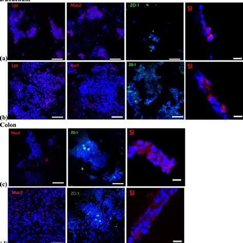 Sem Pictures Of Primary Duodenum Cells And Primary Colon Cells Cultured Download Scientific