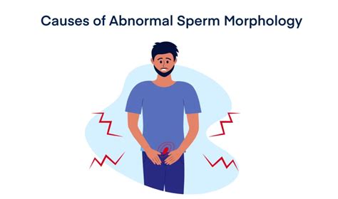 Abnormal Sperm Morphology Cause Range And Treatment