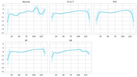 time series anomaly detection using lstm autoencoders with pytorch in