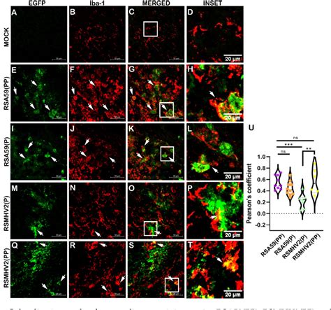Figure 2 From Prolineproline Dyad In The Fusion Peptide Of The Murine