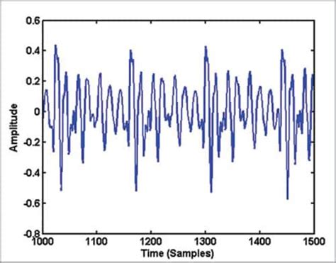 Understanding Spectrogram Of Speech Signal Using Matlab Program Smps Troubleshooting