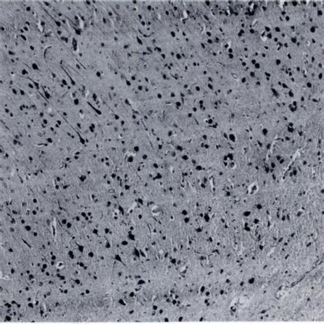 In The Cerebral Cortex Pyramidal Cells And Their Cytoplasmic Processes Download Scientific