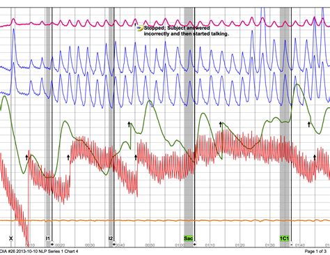 Leaked Documents Point To Dias Inability To Detect Sophisticated Polygraph Countermeasures