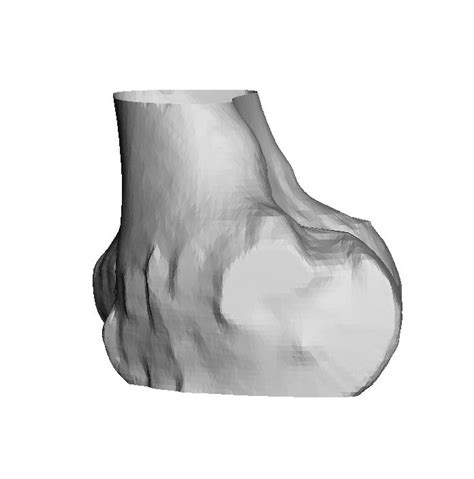 Github Aolwynminimum Area Triangulation Between Two Contours In 3d With Femur Minimum Area