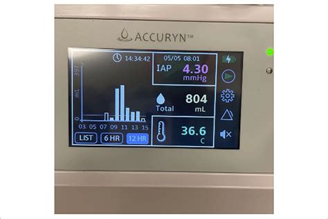 Photo Of The Accuryn Monitoring System S Display Showing Urine