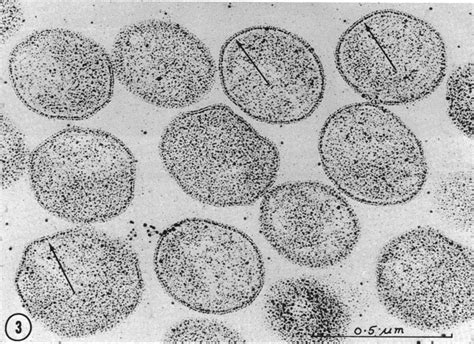 Electron Micrograph Of Sectioned Chlamydia Psittaci Section Treated