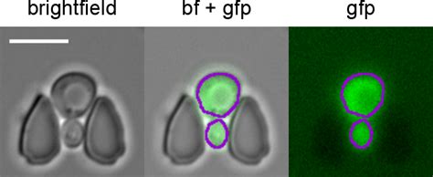 Figure 11 From Multiclass Yeast Segmentation In Microstructured