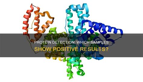 Protein Detection Which Samples Show Positive Results Medshun