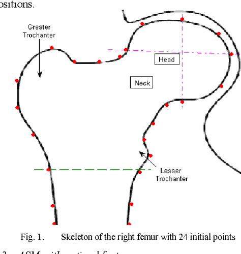 Figure 1 From Segmentation Of Proximal Femur In Digital Radiographic
