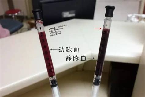 血液是啥色？你真的知道？上 知乎