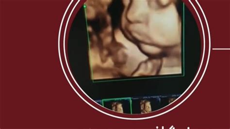 سونوگرافی سه بعدی پسر تپلی نماشا