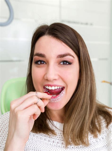 Essix Retainer How It Works And How To Essix Retainer Care