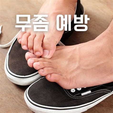 무좀 다양한 치료 방법과 예방 하는법 5가지 트렌드 따라 잡기