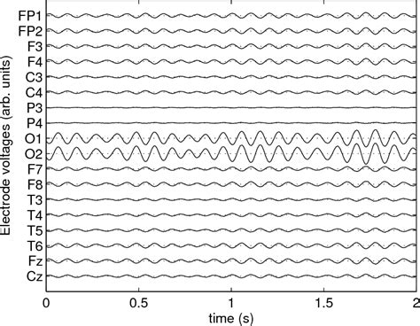 Figure 11 From Kalman Filter Based Eeg Source Localization Semantic