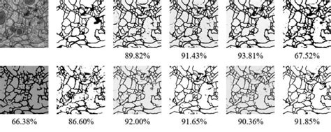 segmentation of isbi 2012 download scientific diagram