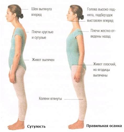 Как исправить осанку? Как выпрямить осанку? Как выровнять осанку? - Кипарис
