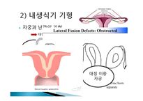 간호학 생식기 구조이상 생식기 기형 성선 발육장애 자궁의 위치 이상 의약학